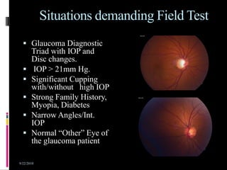 Visual field assessment | PDF