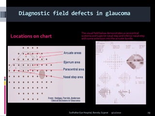 Visual field assessment | PDF