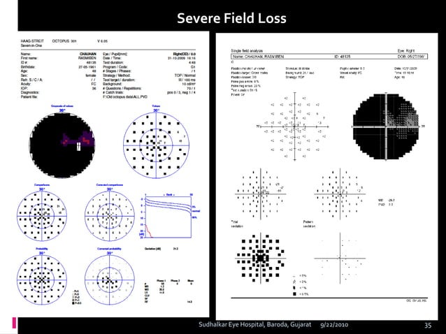 Visual field assessment