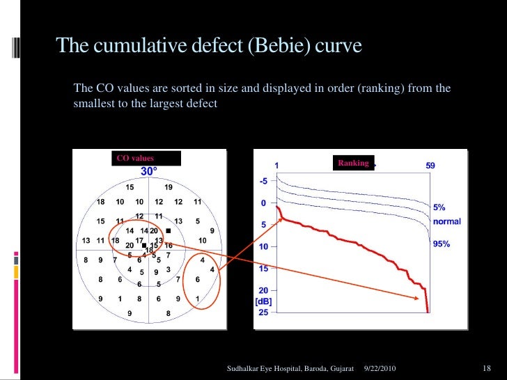 Visual field assessment