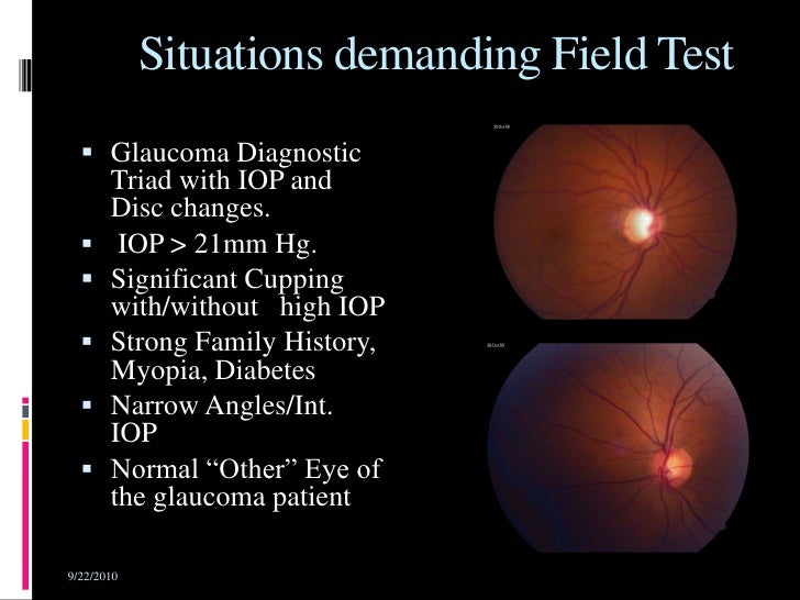 Visual field assessment