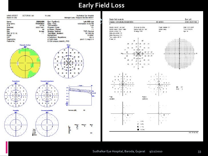 Visual field assessment