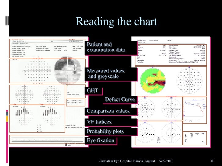 Visual field assessment