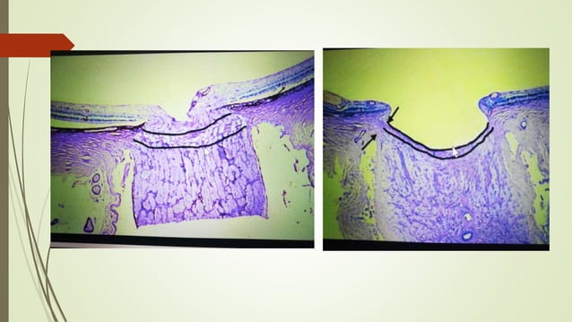 Visual field assessment,optic nerve changes and retinal changes | PPTX