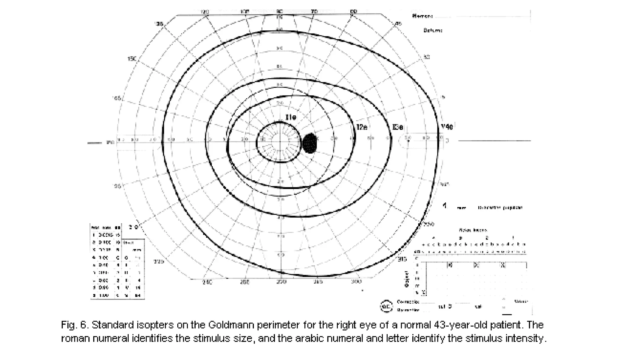 Visual field basics & interpretation | PPTX