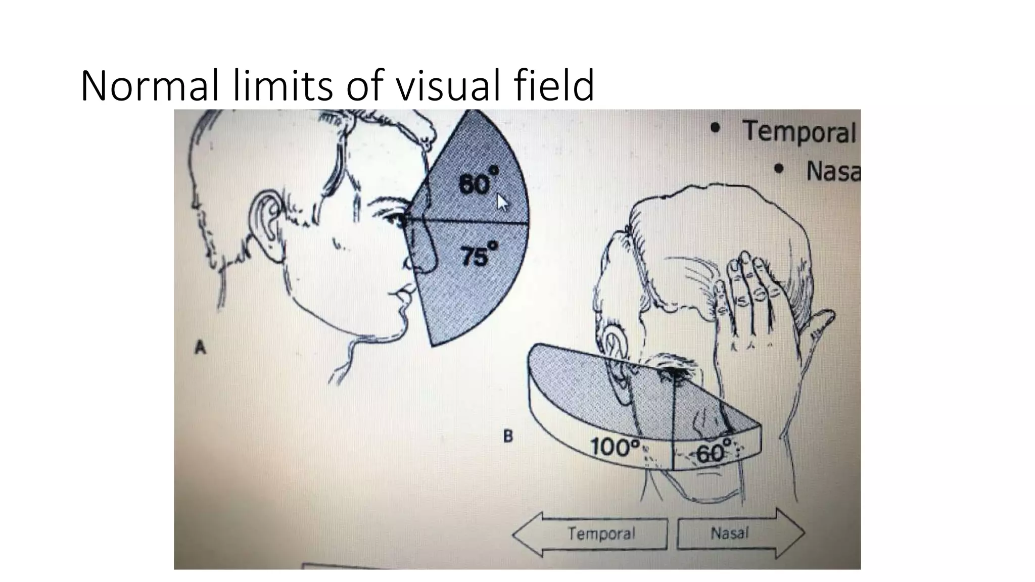 Visual field basics & interpretation | PPTX