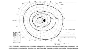 Visual field basics & interpretation | PPTX | Eye and Vision Conditions ...