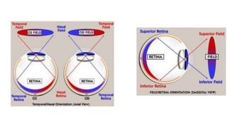 Visual field basics & interpretation | PPTX | Eye and Vision Conditions ...
