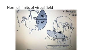 Visual field basics & interpretation | PPTX | Eye and Vision Conditions ...