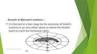 VISUAL FIELD CHANGES IN GLAUCOMA by dr nanish.pptx