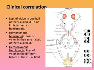 Visual field defects and light reflex | PPT