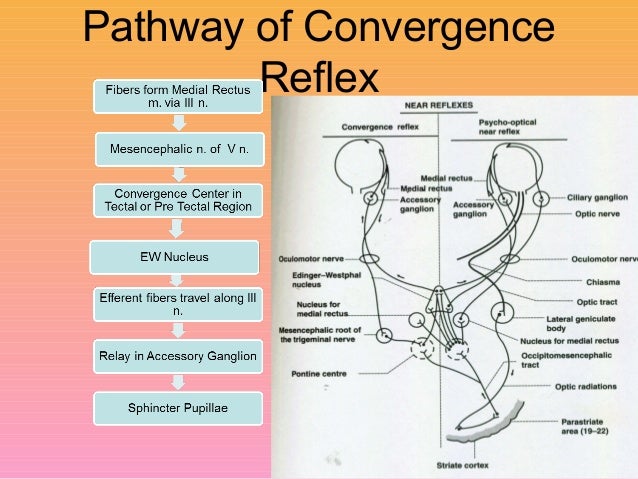 Visual field defects and light reflex