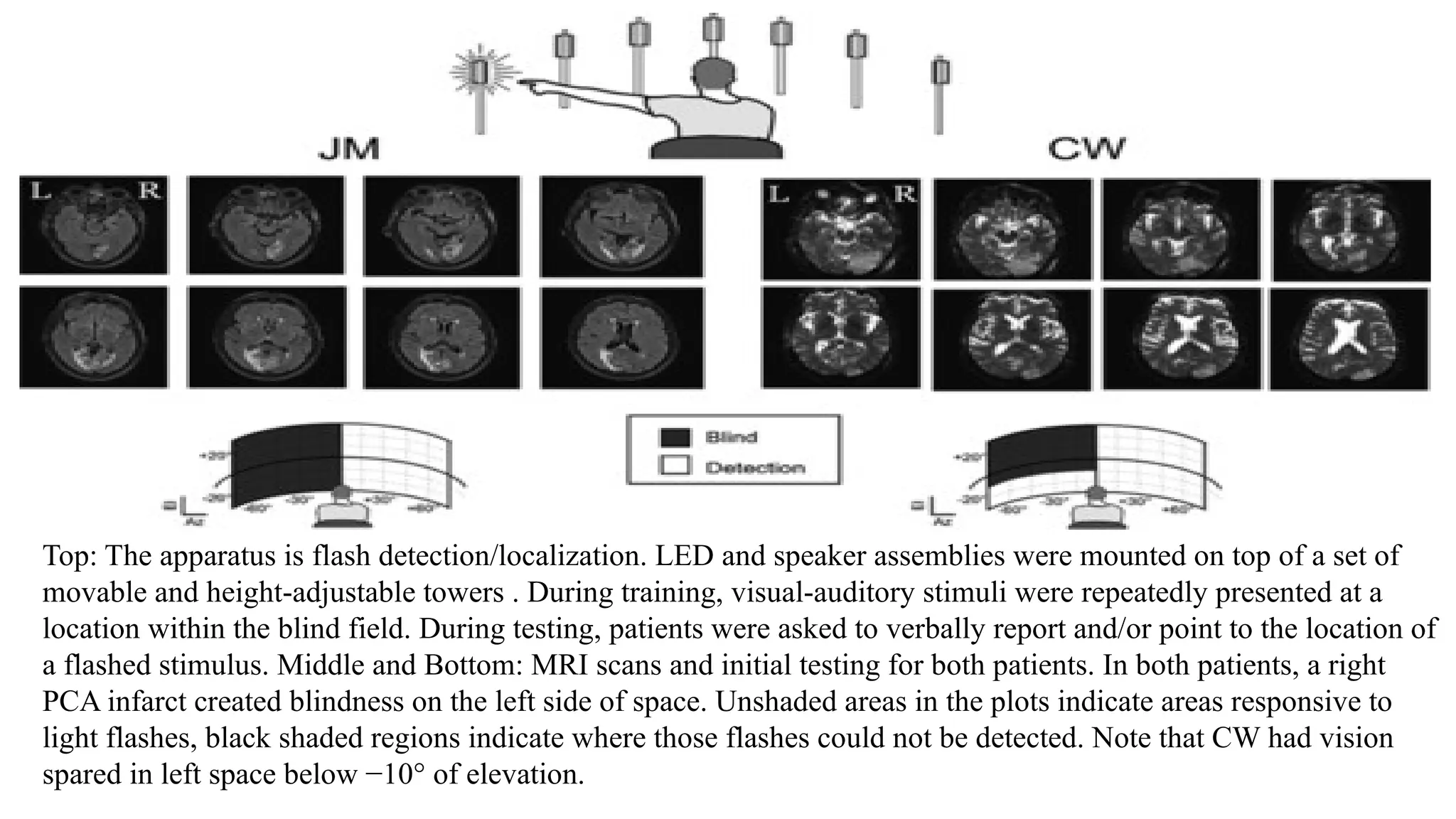VISUAL FIELD ENHANCING TECHNIQUES FOR PATIENTS WITH HEMIANOPIA FIELD.pptx