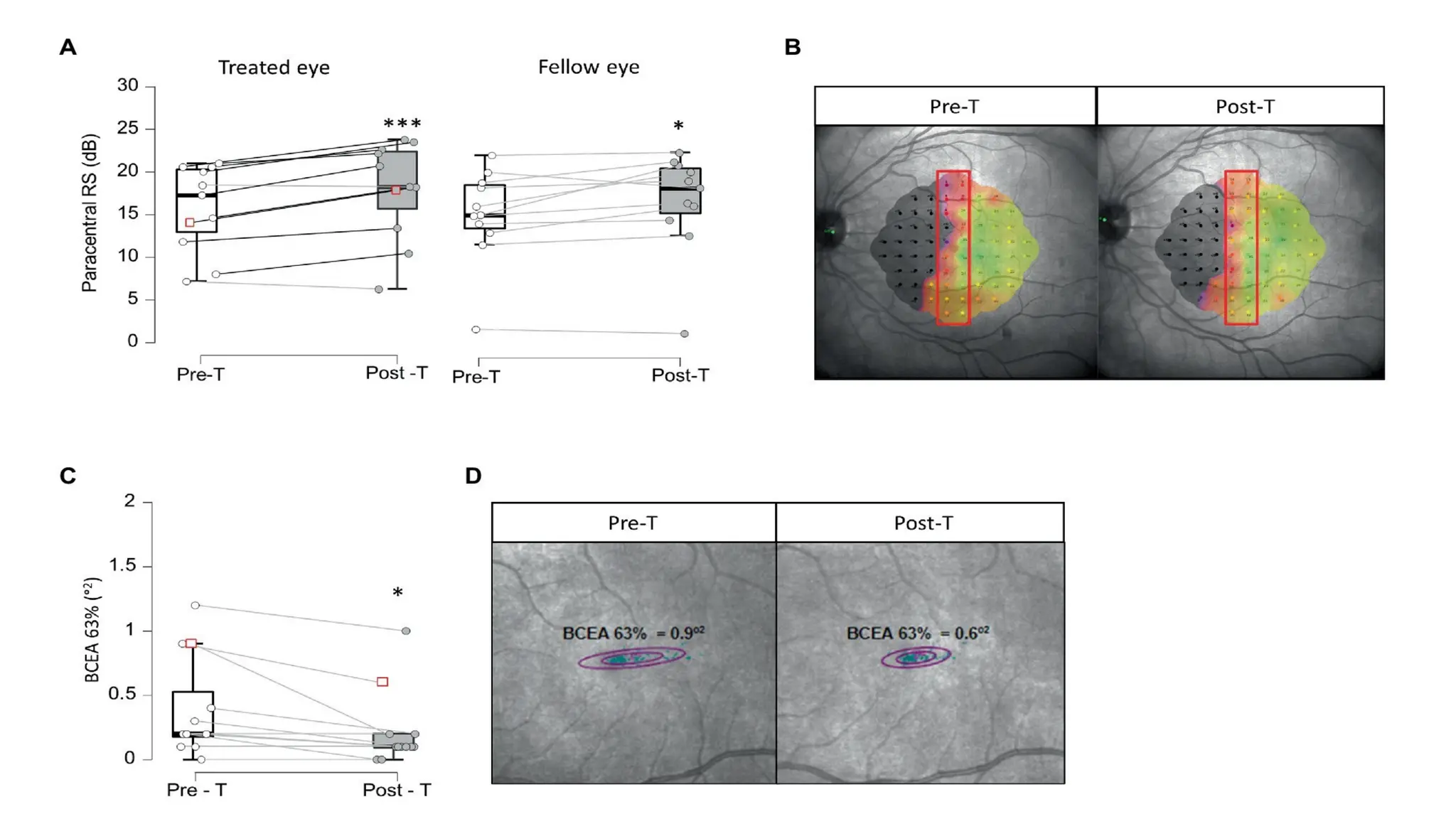 VISUAL FIELD ENHANCING TECHNIQUES FOR PATIENTS WITH HEMIANOPIA FIELD.pptx