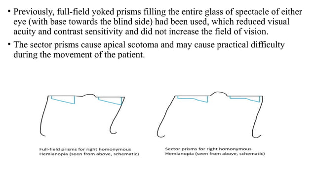 VISUAL FIELD ENHANCING TECHNIQUES FOR PATIENTS WITH HEMIANOPIA FIELD ...