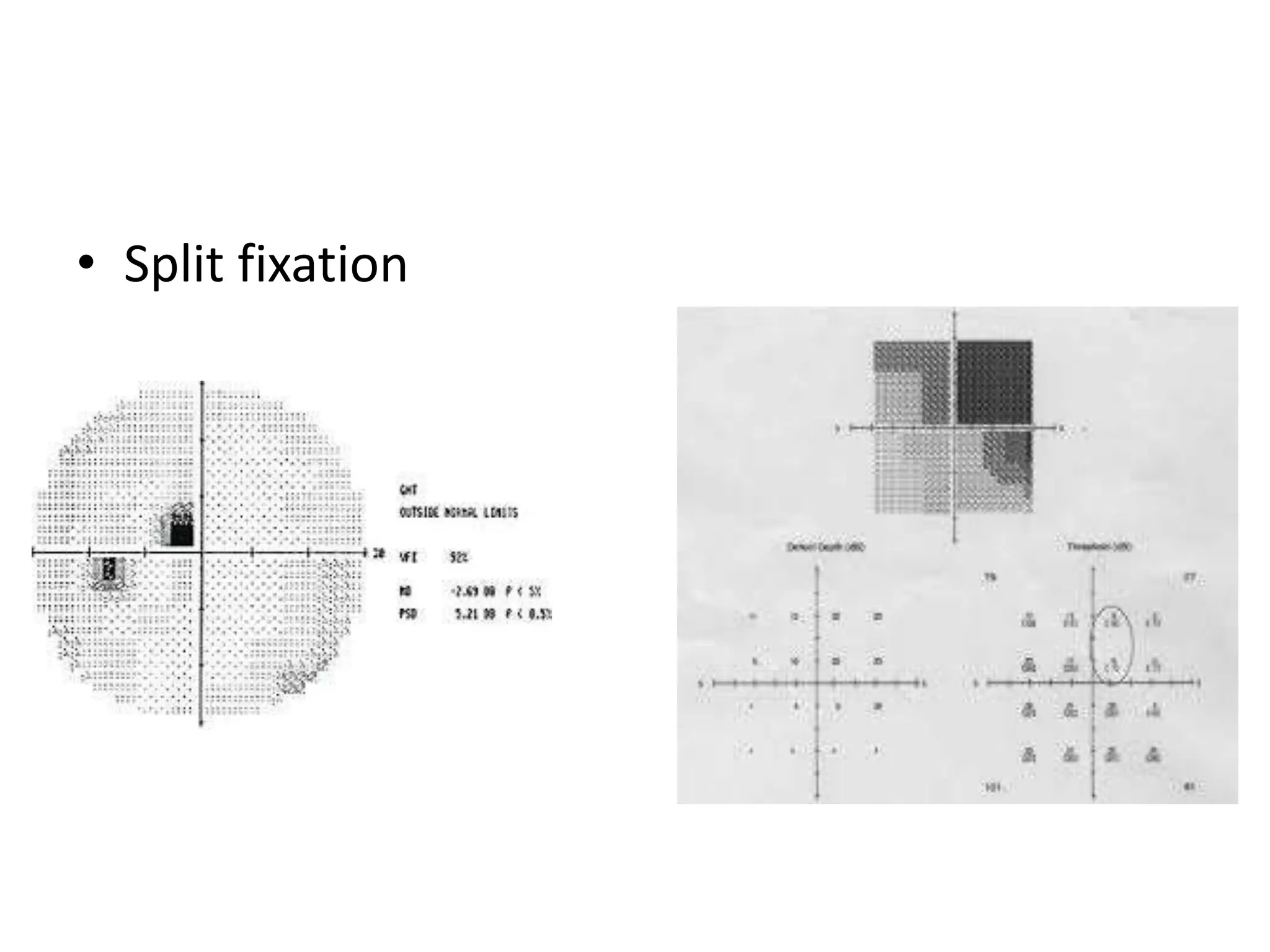 Visual field examination | PPTX