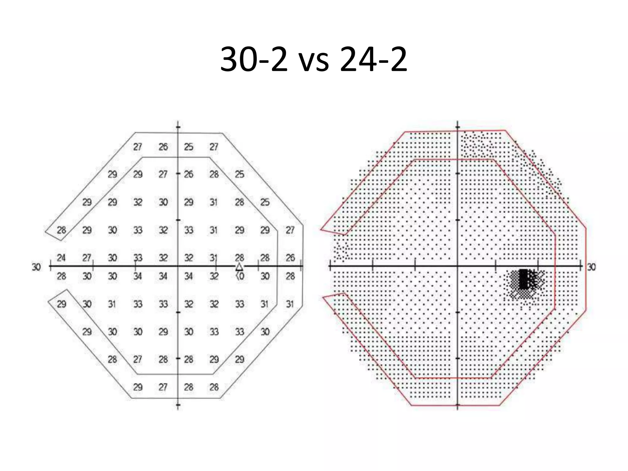 Visual field examination | PPTX