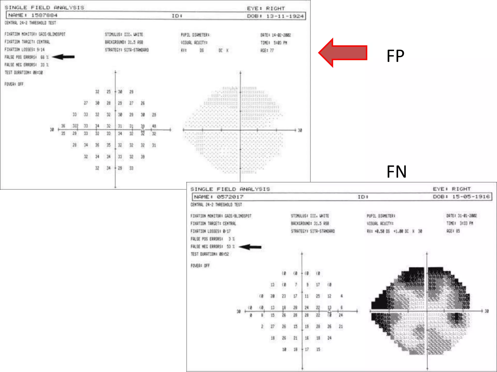 Visual field examination | PPTX