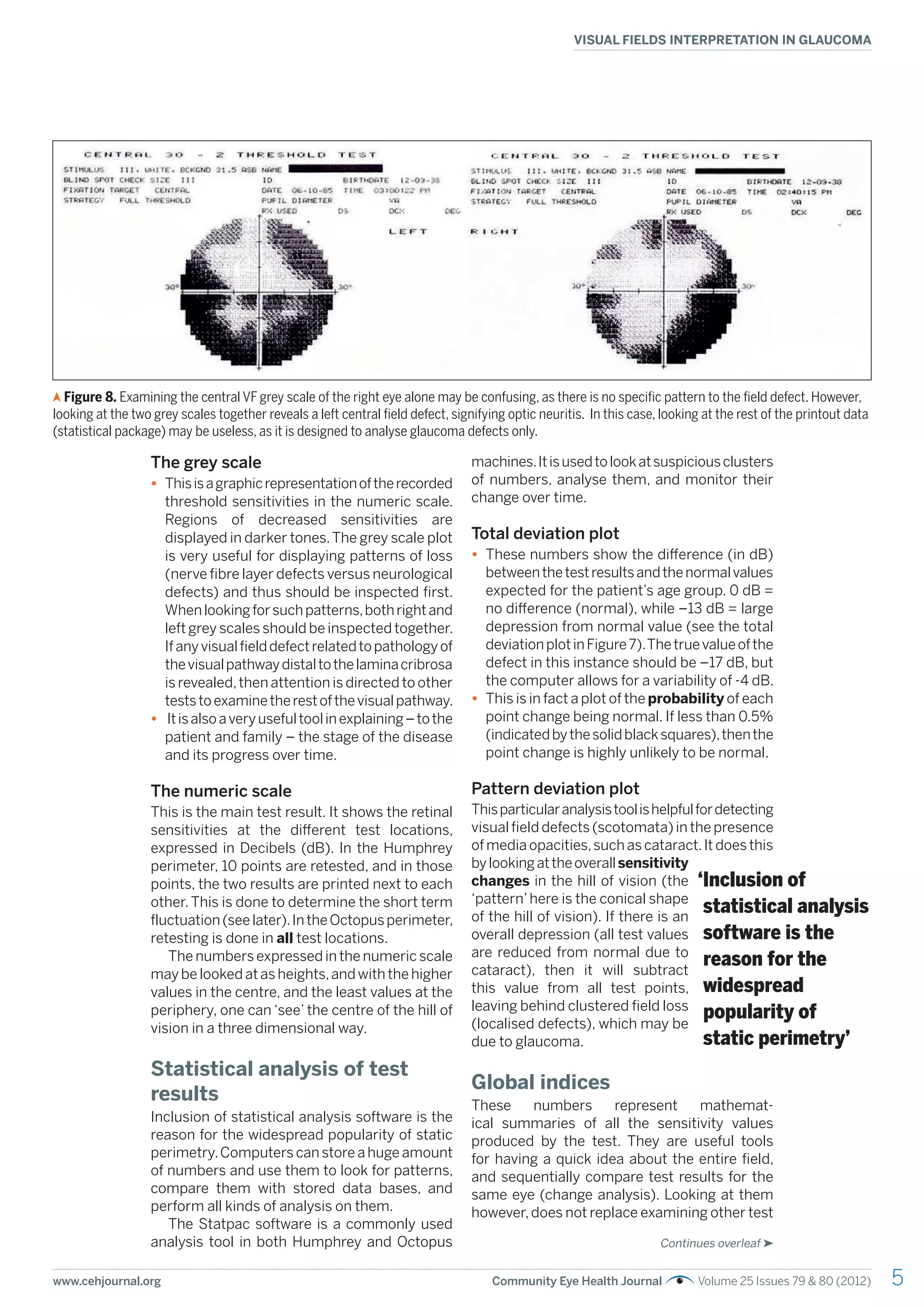 visual field interpretation 1.pdf