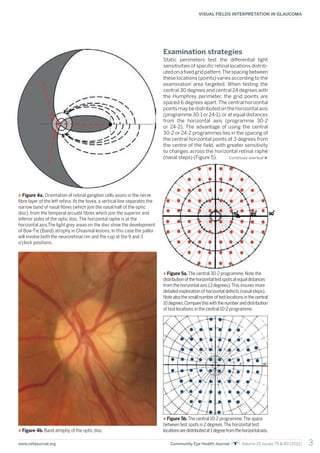 visual field interpretation 1.pdf