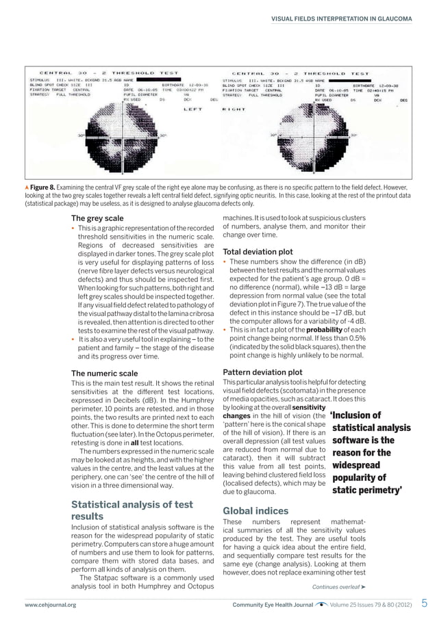 visual field interpretation 1.pdf