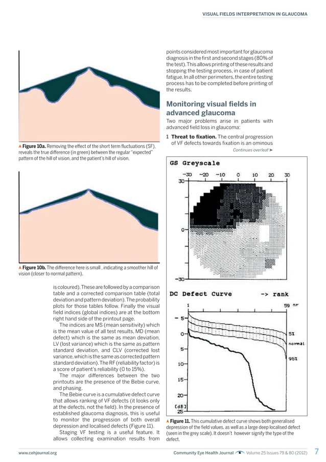 visual field interpretation 1.pdf