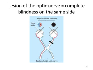 VISUAL FIELD AND PATHWAY (Neuroanatomy). | PPT