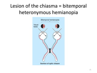 VISUAL FIELD AND PATHWAY (Neuroanatomy). | PPT