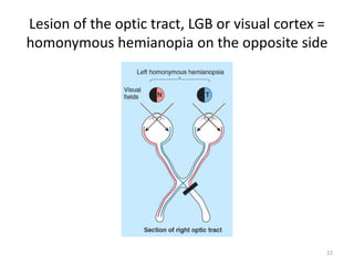 VISUAL FIELD AND PATHWAY (Neuroanatomy). | PPT