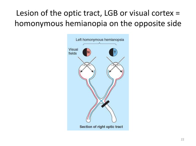 VISUAL FIELD AND PATHWAY (Neuroanatomy). | PPT