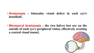 Visual field report | PPT