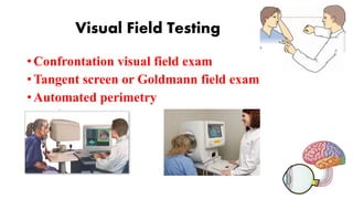 Visual field report | PPT