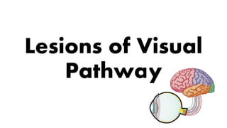 Visual field report | PPT