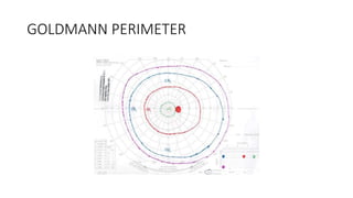 VISUAL FIELDS and perimetry interpretation | PPTX