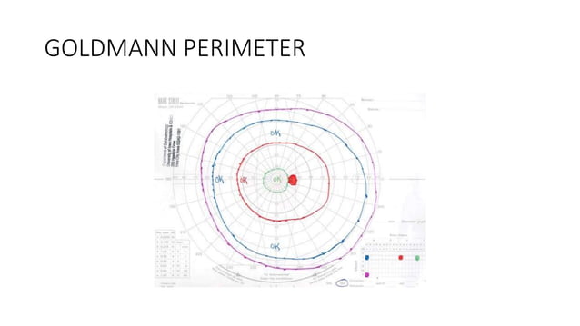 VISUAL FIELDS , PERIMETRY, INTERPRETATION | PPT