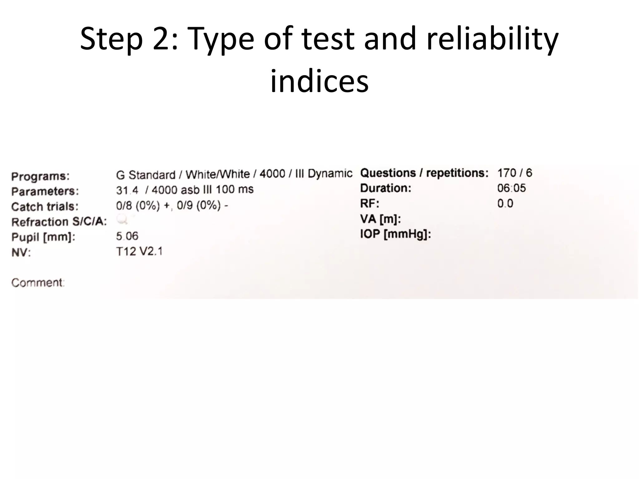 Interpretation of visual fields with special reference to octopus | PDF