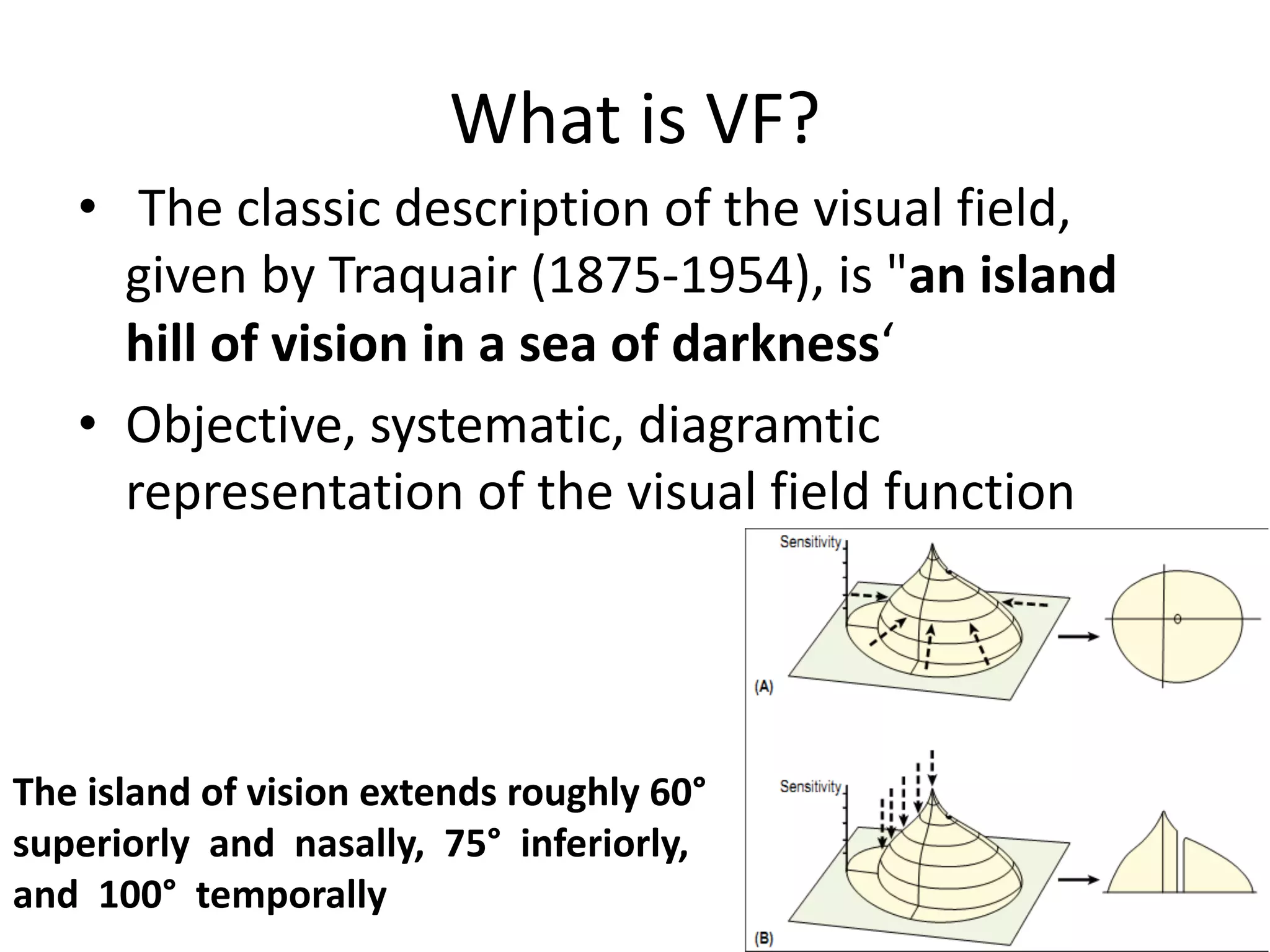 Interpretation of visual fields with special reference to octopus | PDF