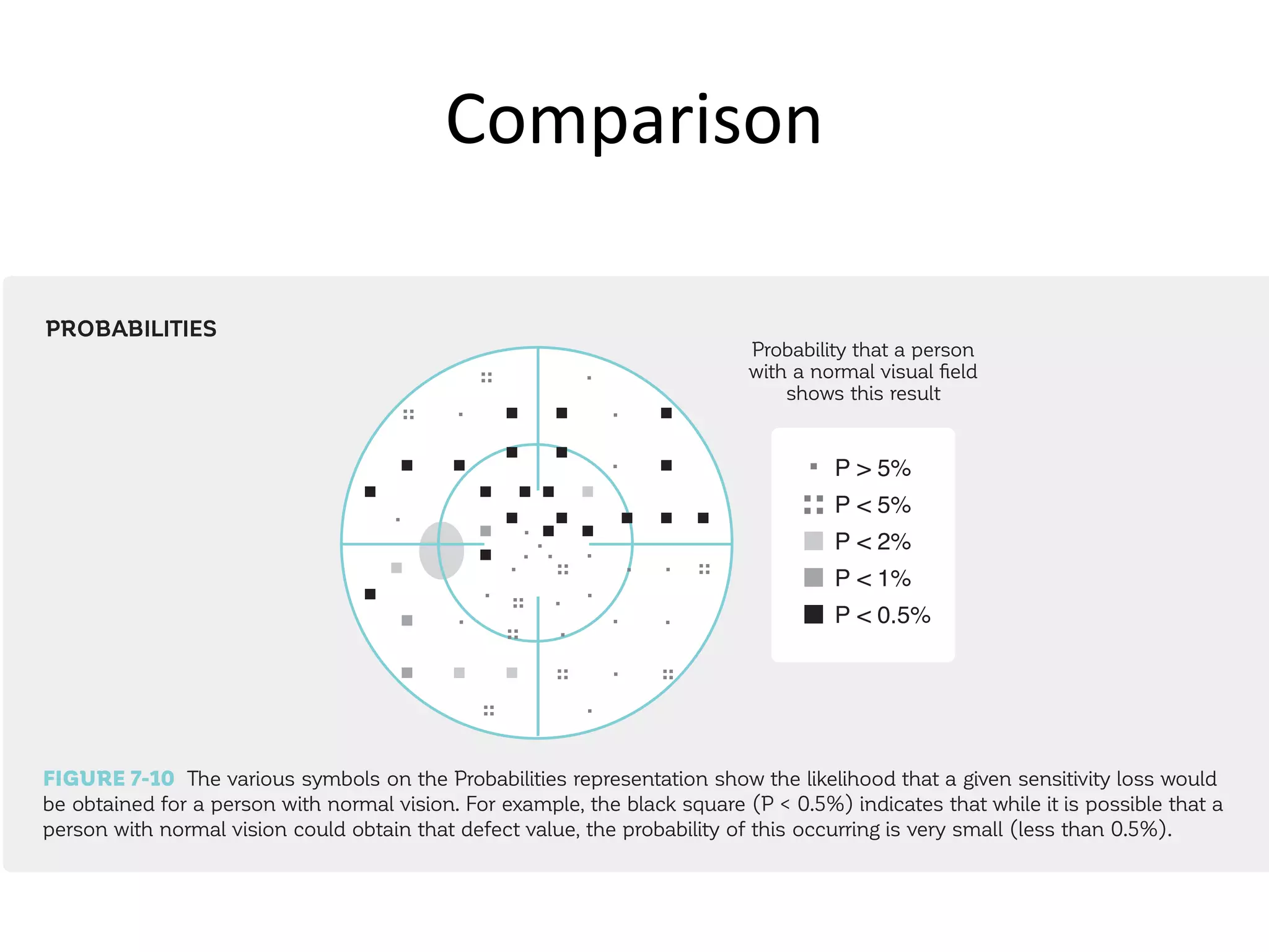 Interpretation of visual fields with special reference to octopus | PDF