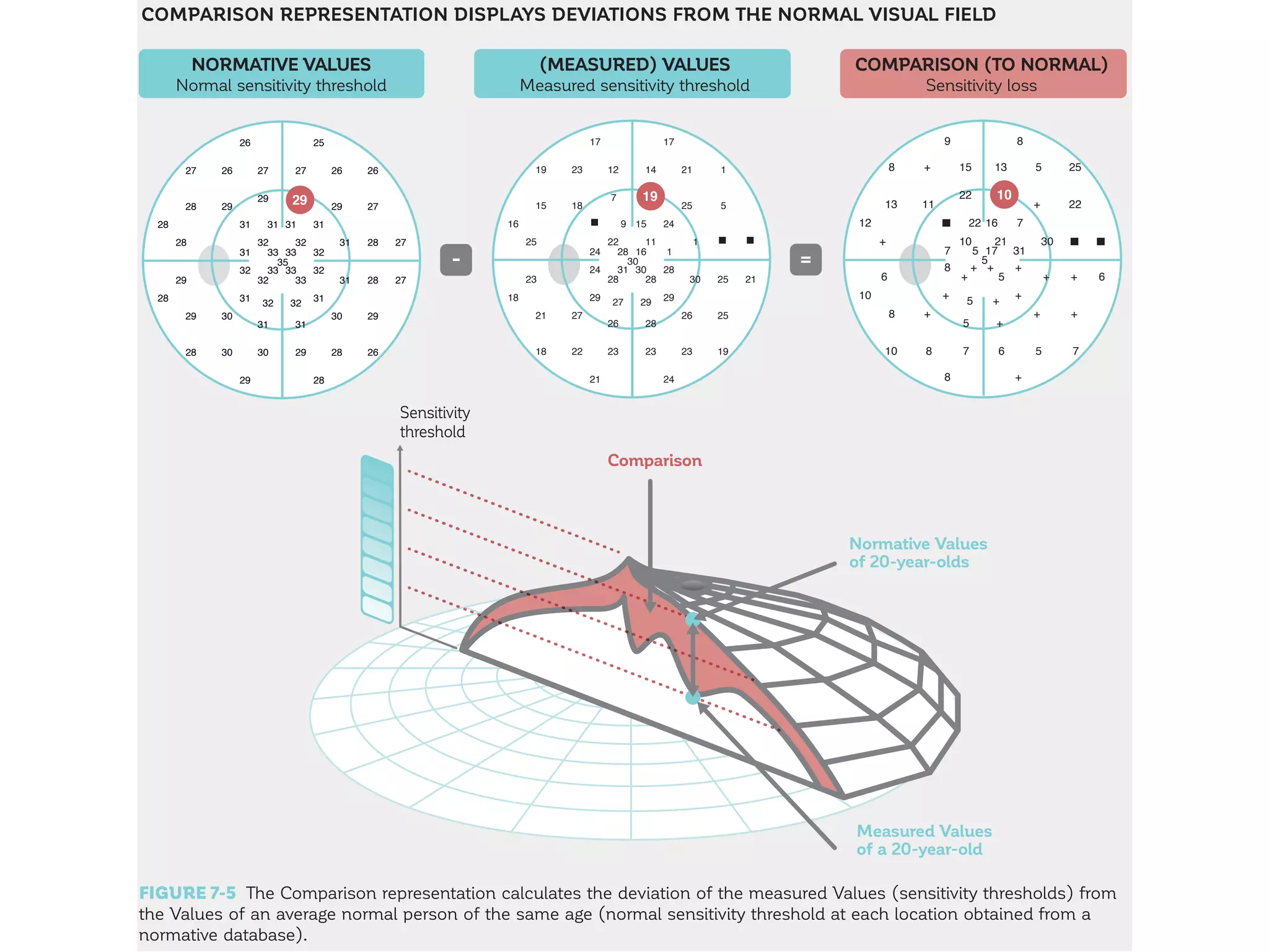 Interpretation of visual fields with special reference to octopus | PDF