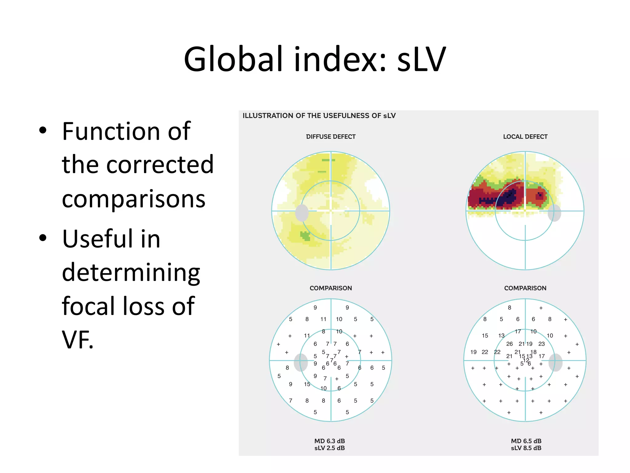 Interpretation of visual fields with special reference to octopus | PDF