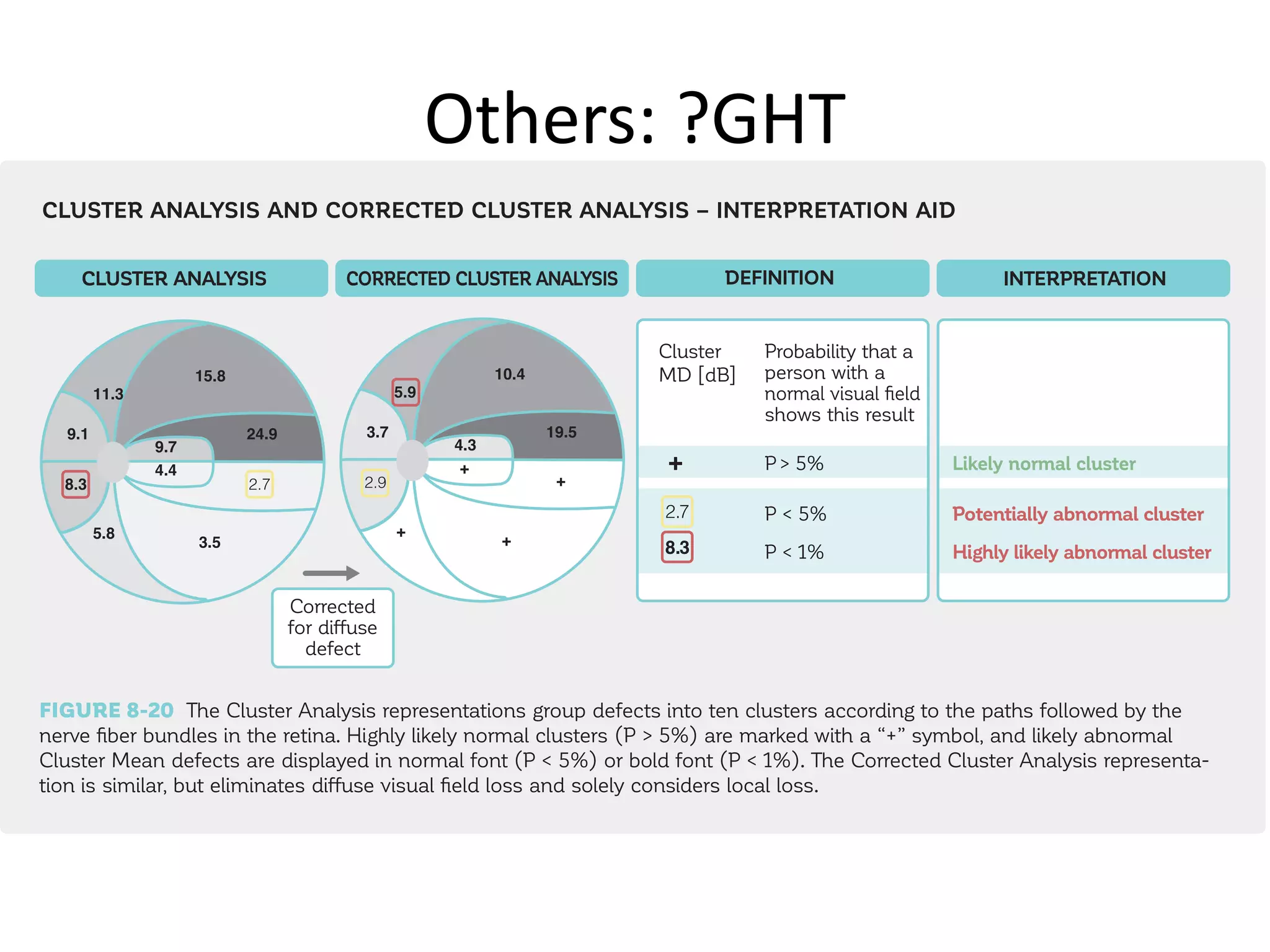 Interpretation of visual fields with special reference to octopus | PDF
