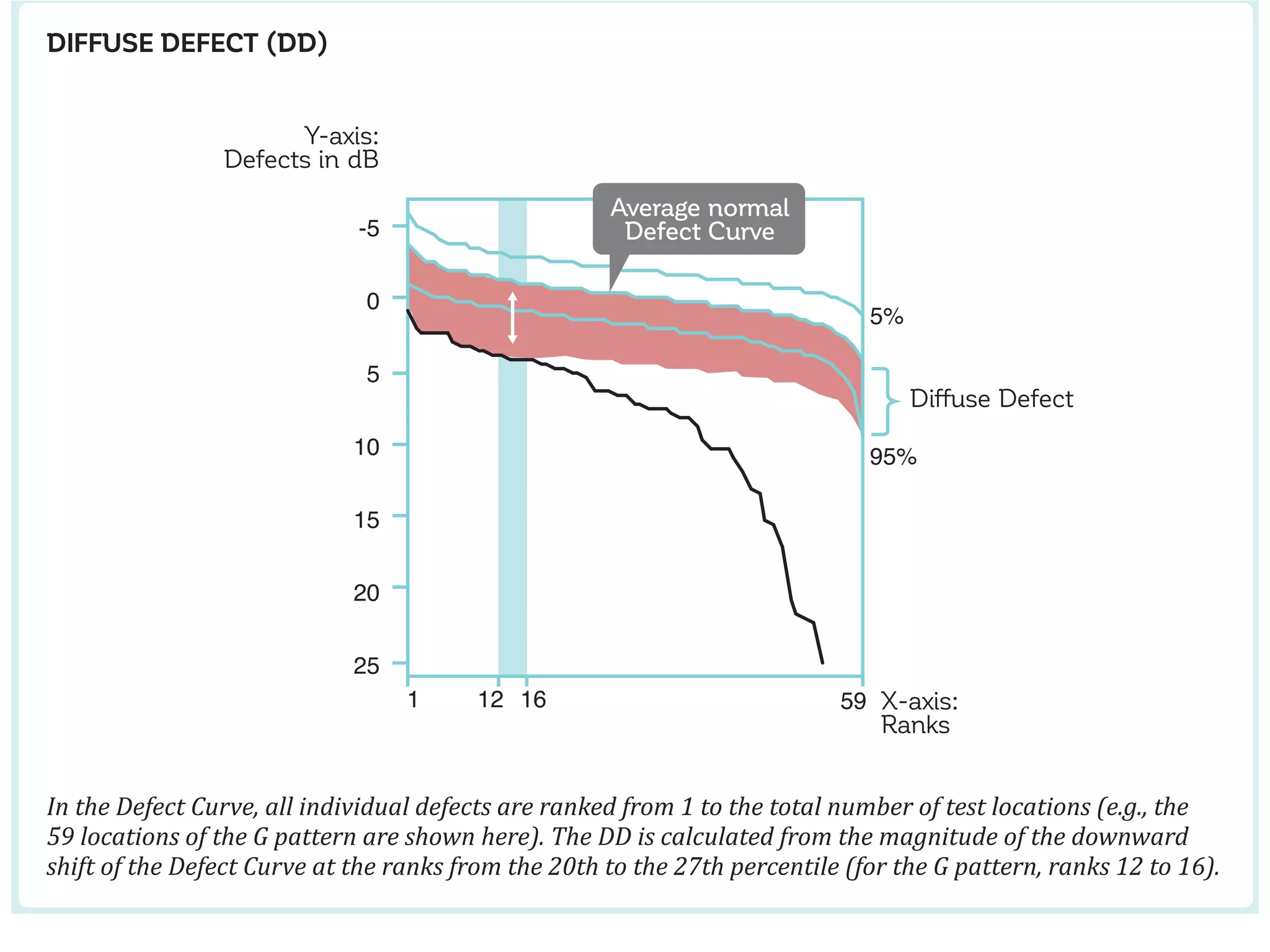 Interpretation of visual fields with special reference to octopus | PDF