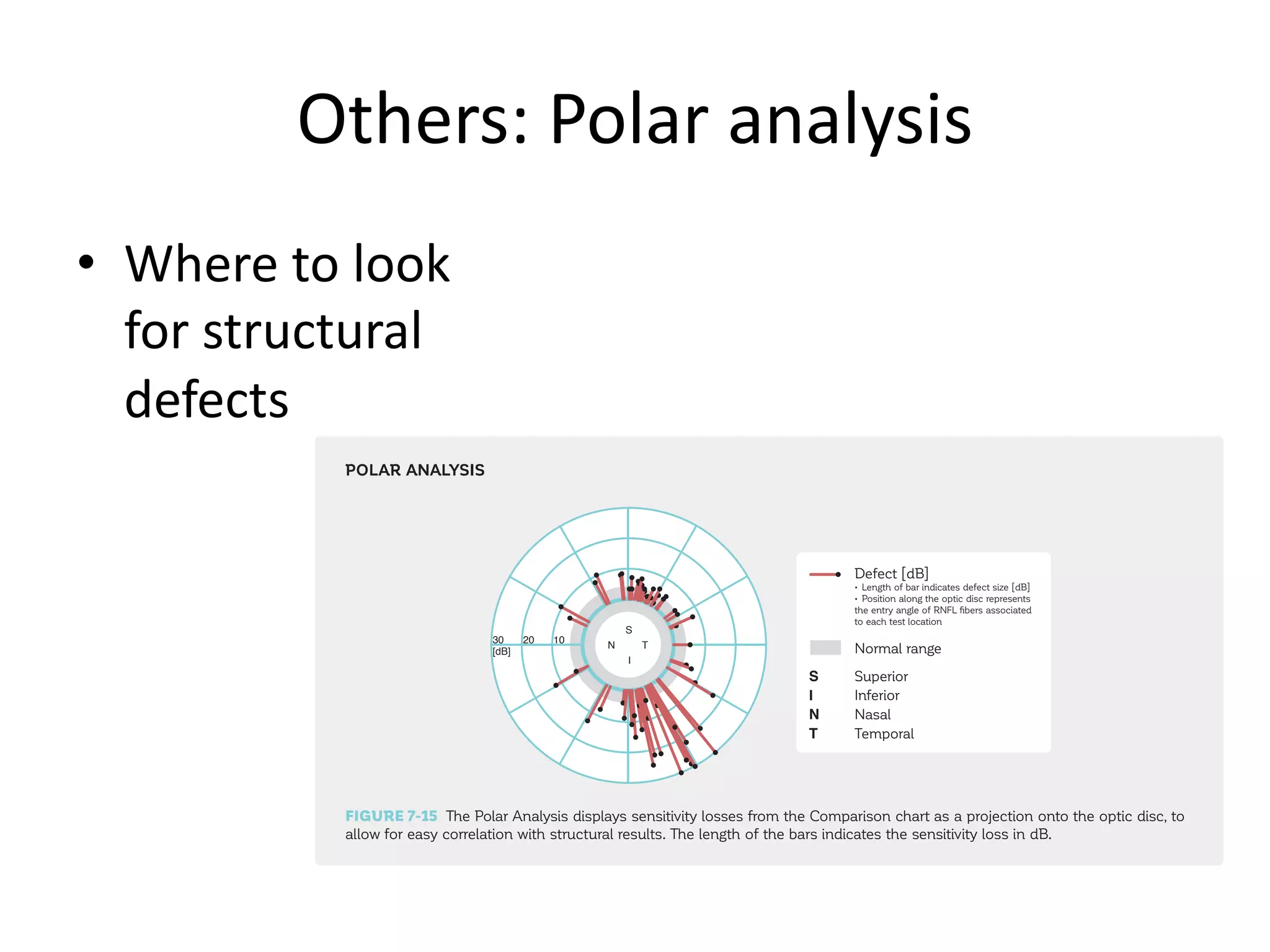 Interpretation of visual fields with special reference to octopus | PDF