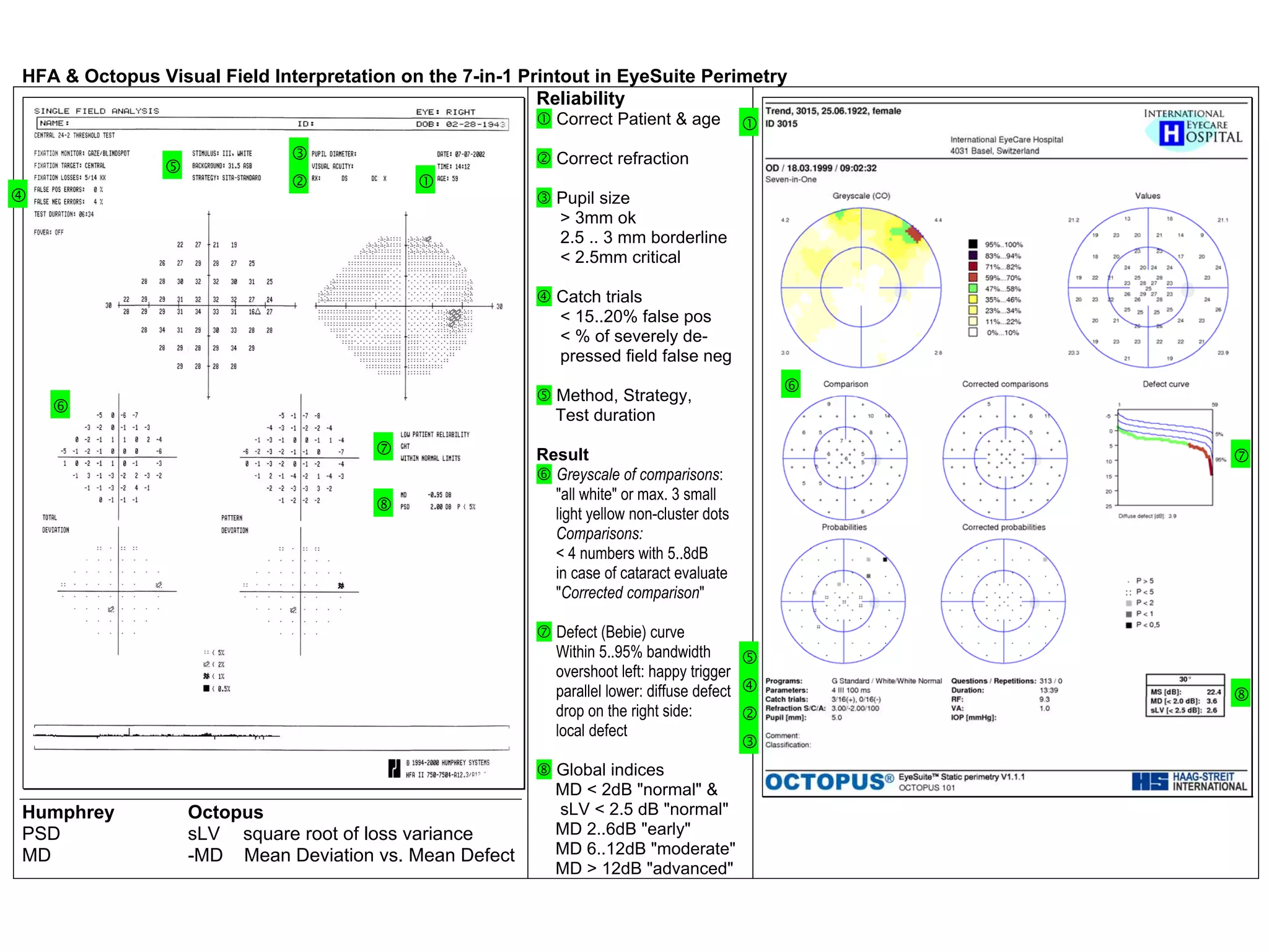 Interpretation of visual fields with special reference to octopus | PDF