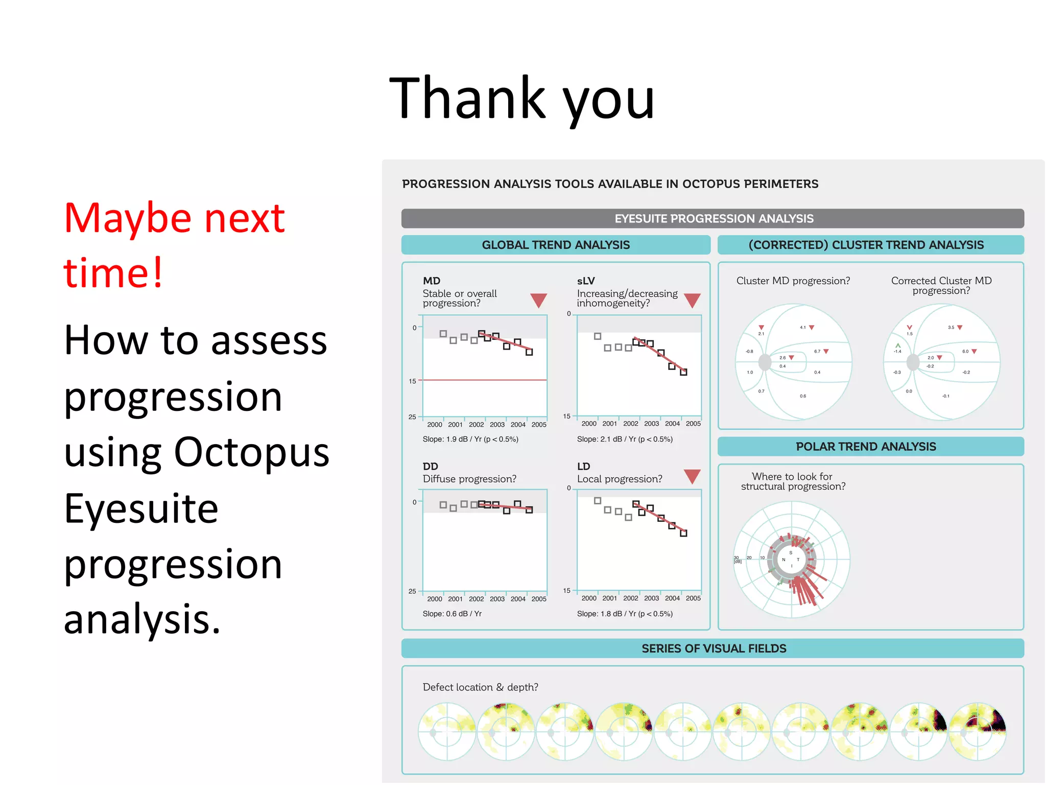 Interpretation of visual fields with special reference to octopus | PDF