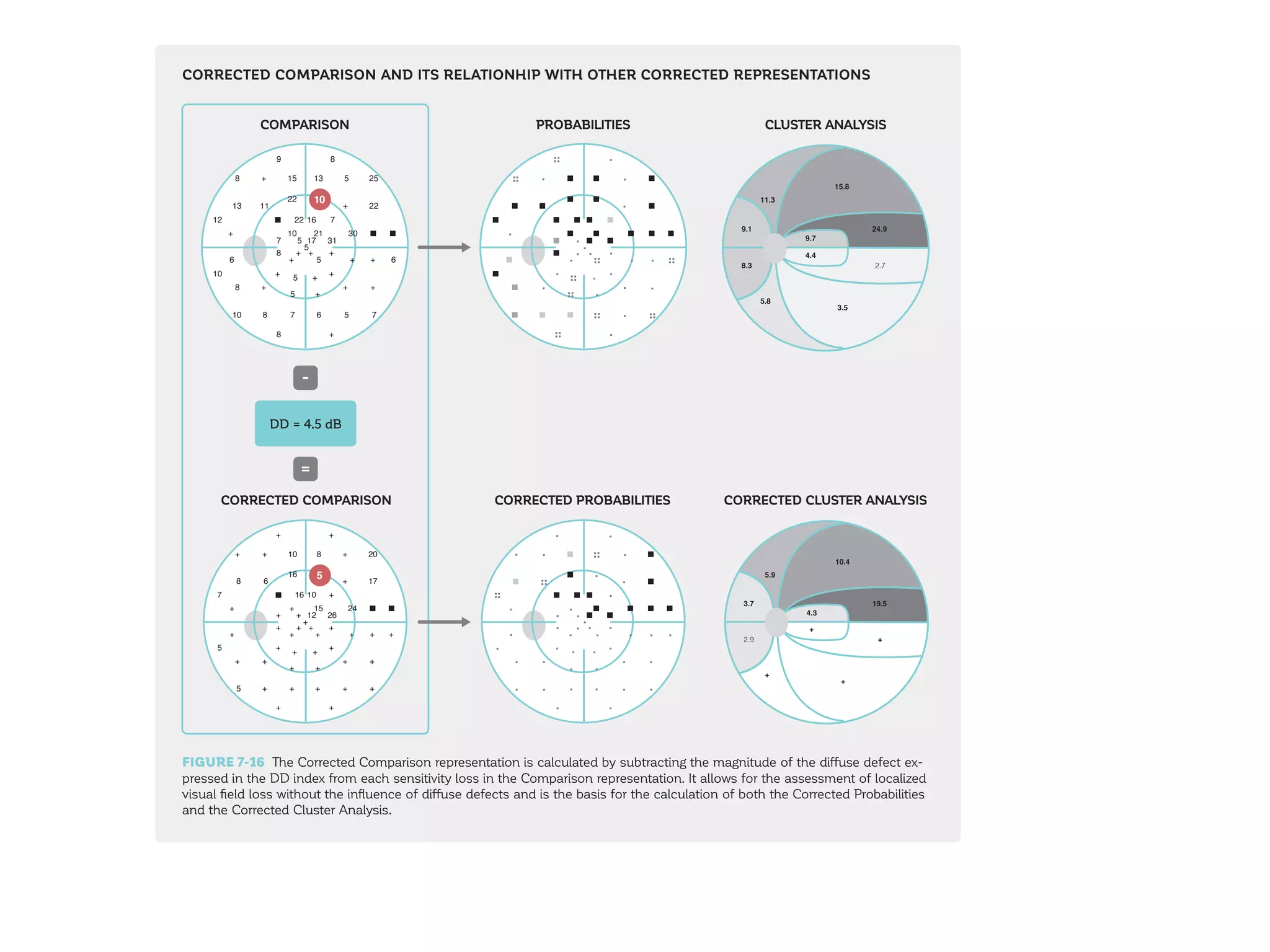 Interpretation of visual fields with special reference to octopus | PDF