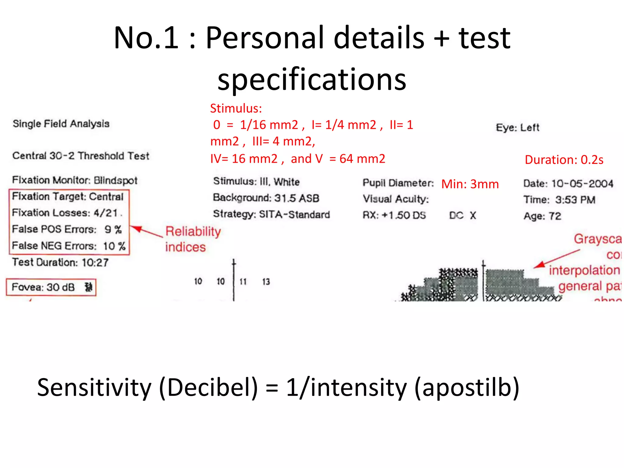 Interpretation of visual fields with special reference to octopus | PDF