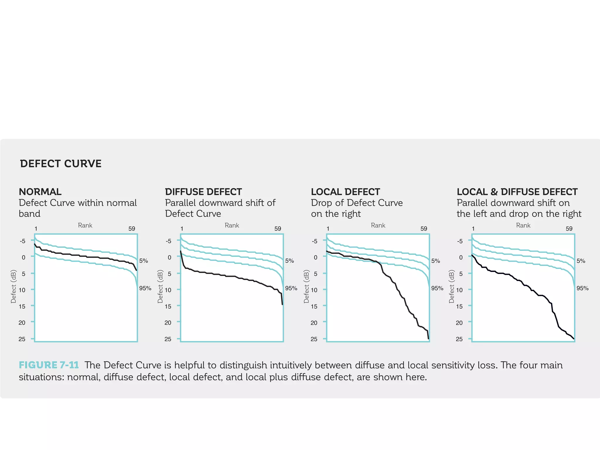Interpretation of visual fields with special reference to octopus | PDF