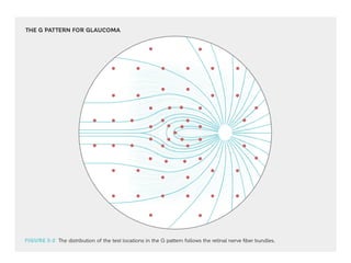 Interpretation of visual fields with special reference to octopus | PDF