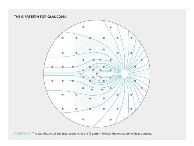Interpretation of visual fields with special reference to octopus | PDF